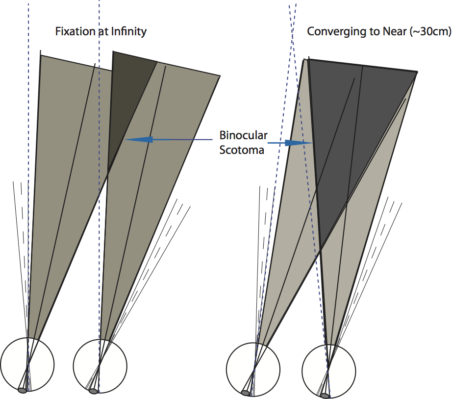 Tracking a target in depth with central field loss | Smith-Kettlewell ...