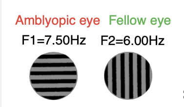 Binocular Rivalry Research: Neural Processing in Cortical Hierarchy